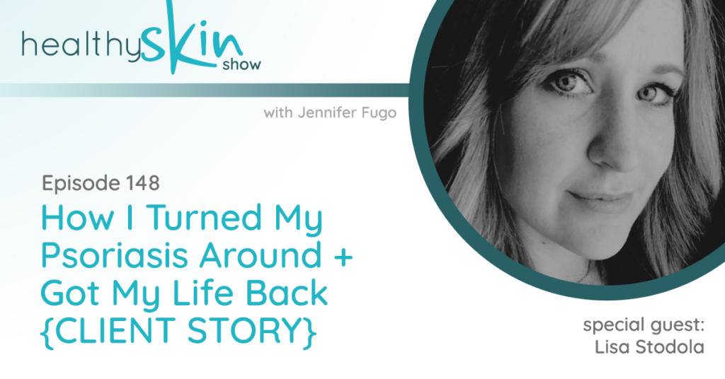 148: How I Turned My Psoriasis Around + Got My Life Back {CLIENT STORY ...