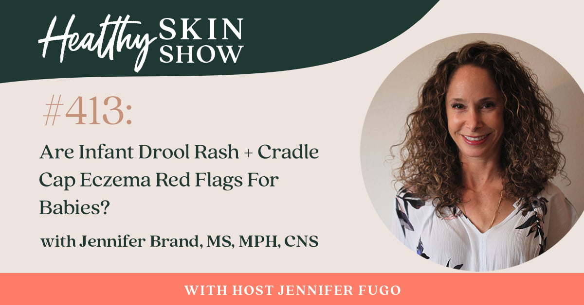 Infant Drool Rash & Cradle Cap As Eczema Triggers For Babies